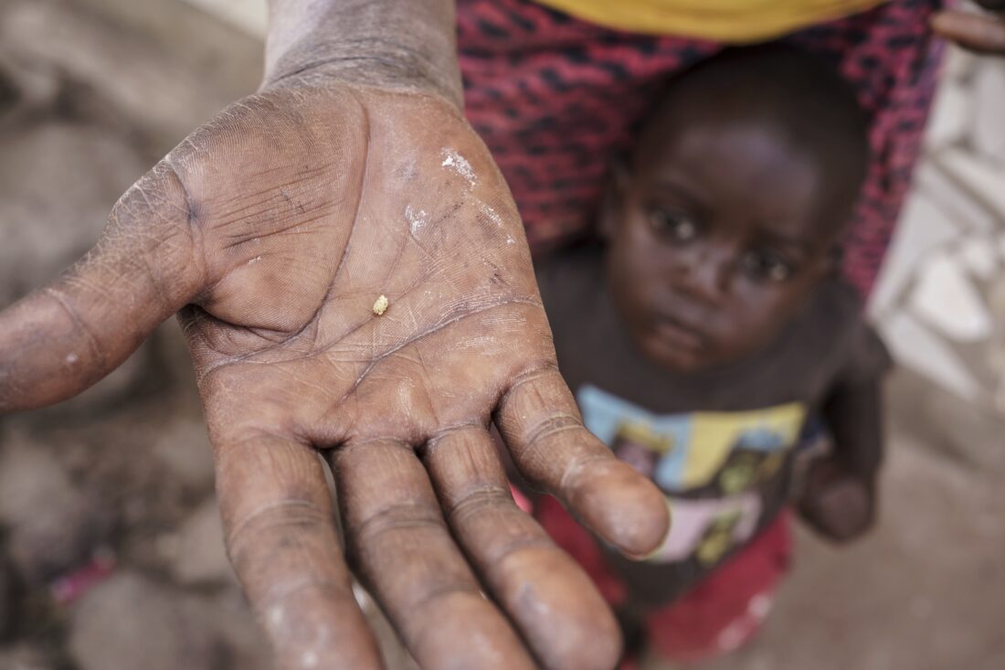Mercury fuels gold mining in Senegal. And it’s poisoning the people who ...